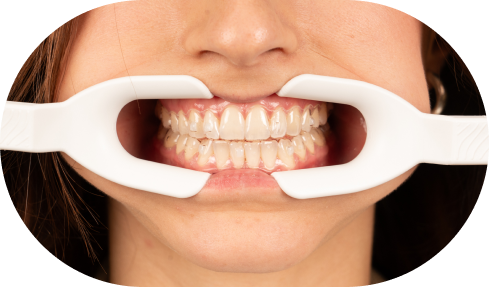 1.1 Como Funciona - Muak